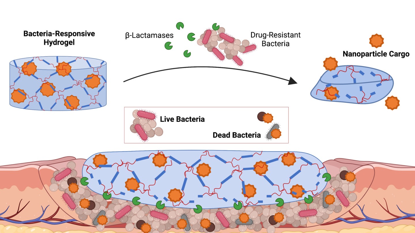 Responsive Drug-Delivery System Releases Antibiotics in Presence of ...